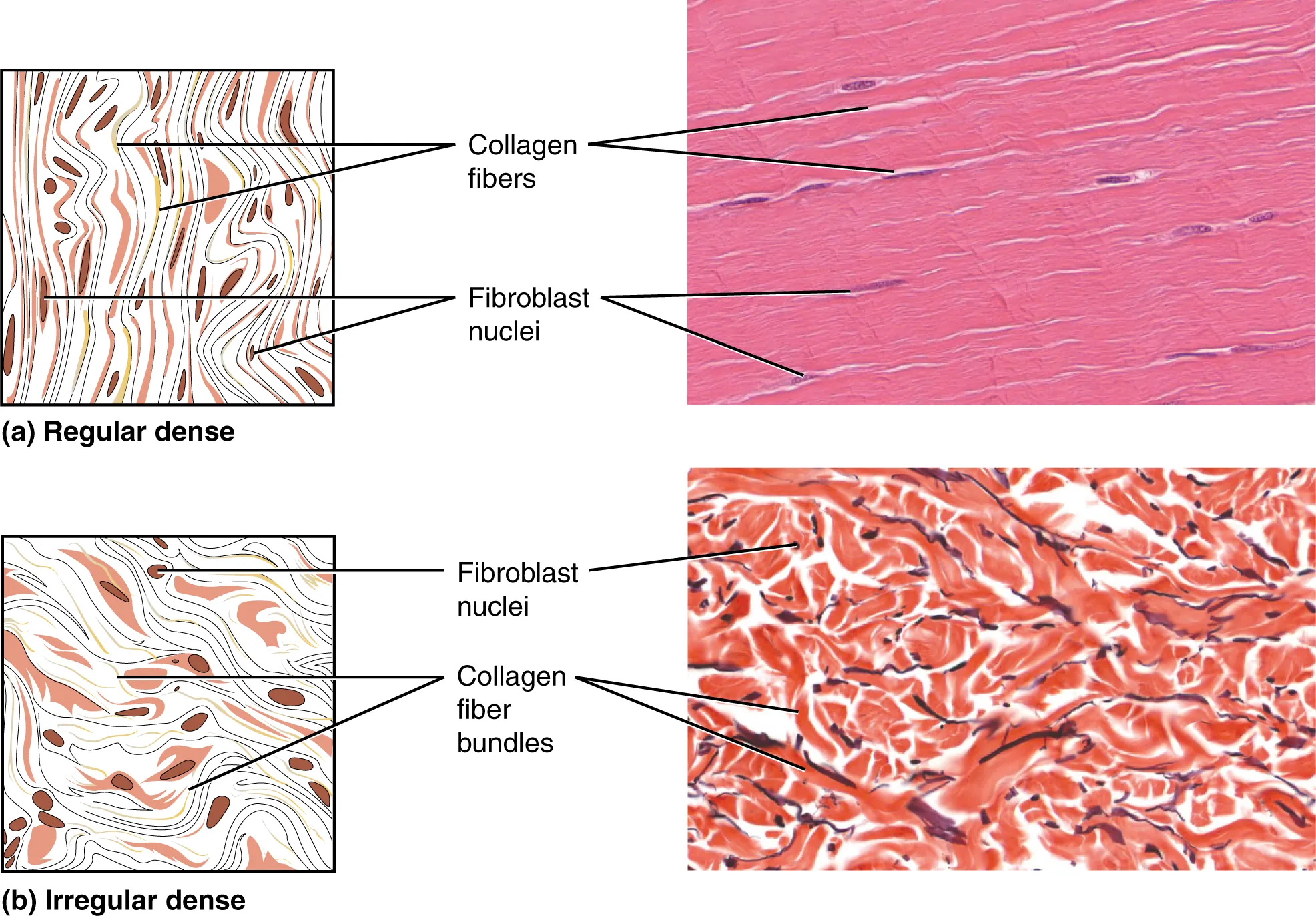 Hyaline Cartilage Connective Tissue Labeled