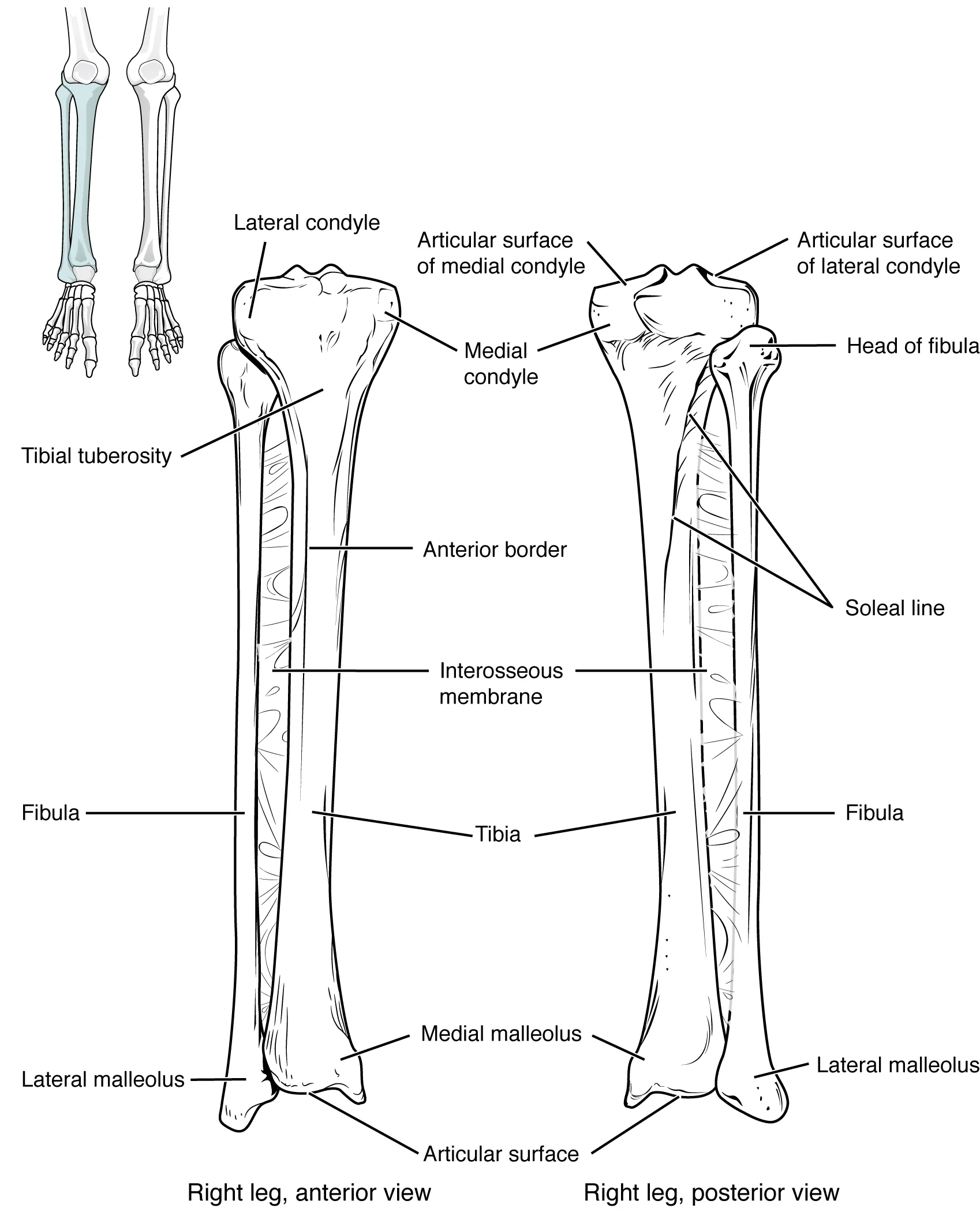 Femur Labeled Anterior View