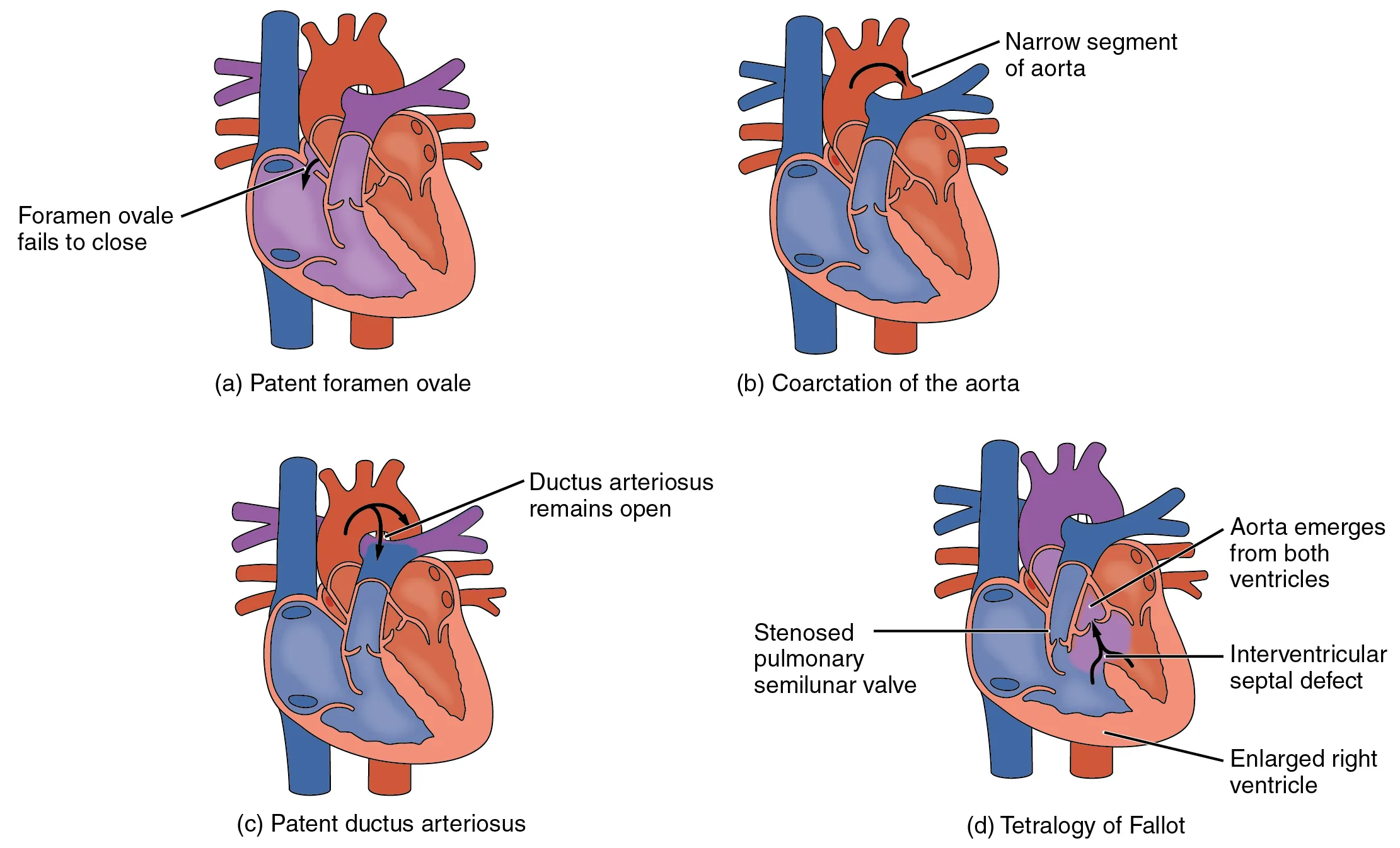 19.1 Heart Anatomy - Anatomy and Physiology | OpenStax
