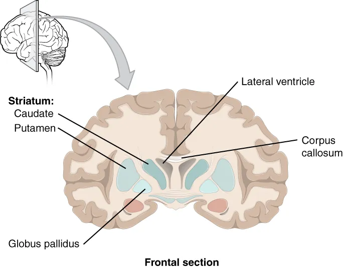 Lobotomy Diagram