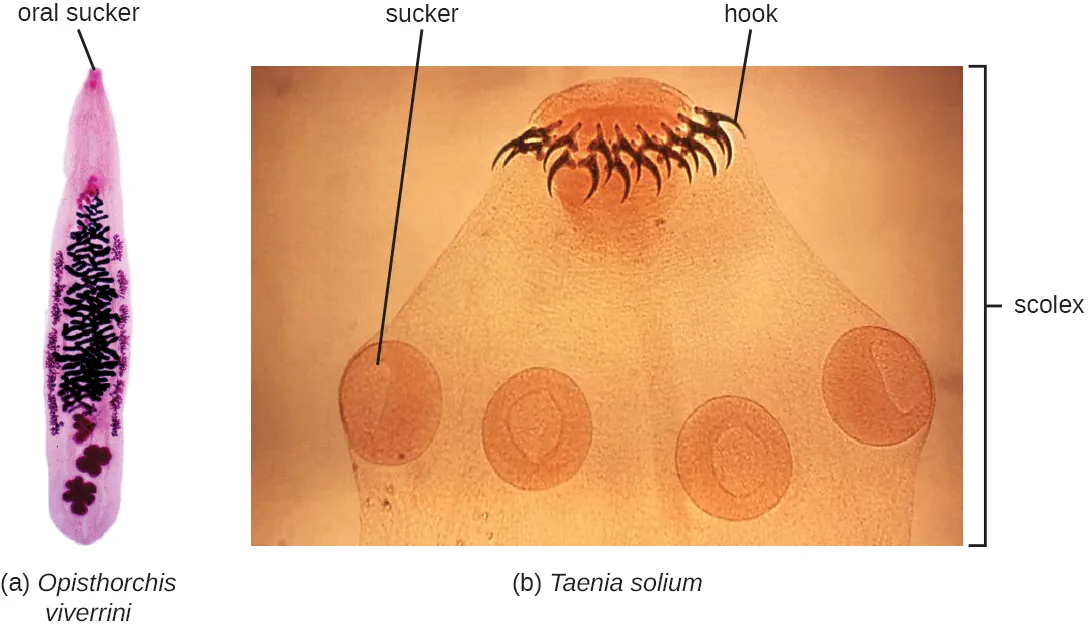 Fasciolopsis Buski Labeled