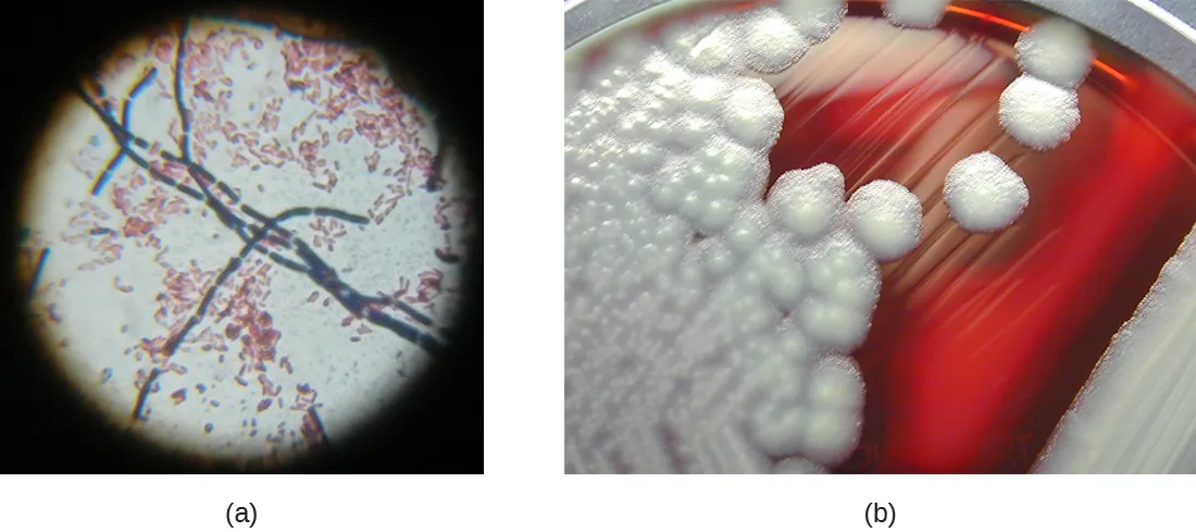 4.4 Gram-Positive Bacteria – Microbiology (OpenStax)